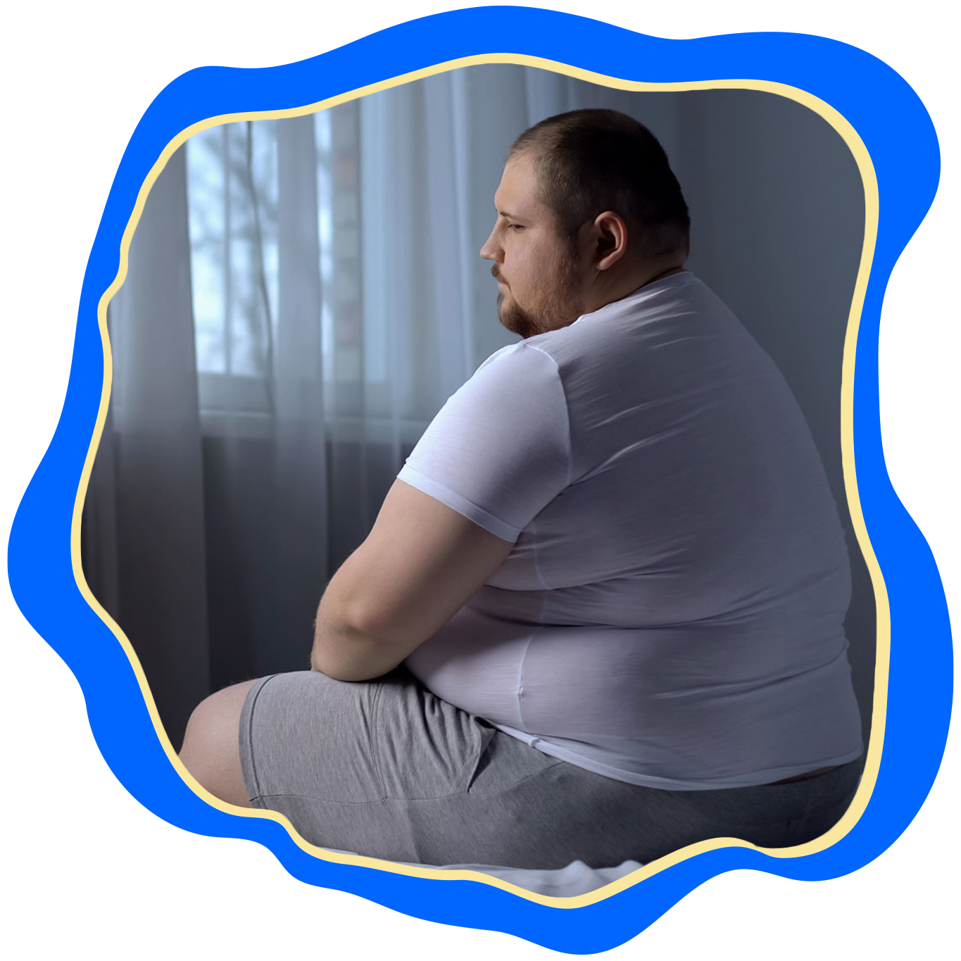 Hidradenitis Suppurativa Clinical Research Study